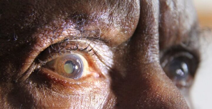 Viewpoint Specialist Eye Centre